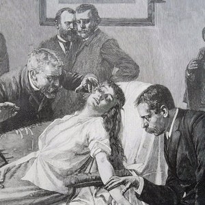 HYPNOSIS Girl Hypnotized in Medical School - 1890s Victorian Era ...