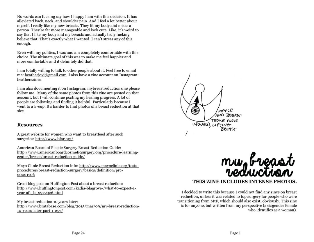 DIGITAL My Breast Reduction Zine Perzine Intense Photos Zinester - Etsy