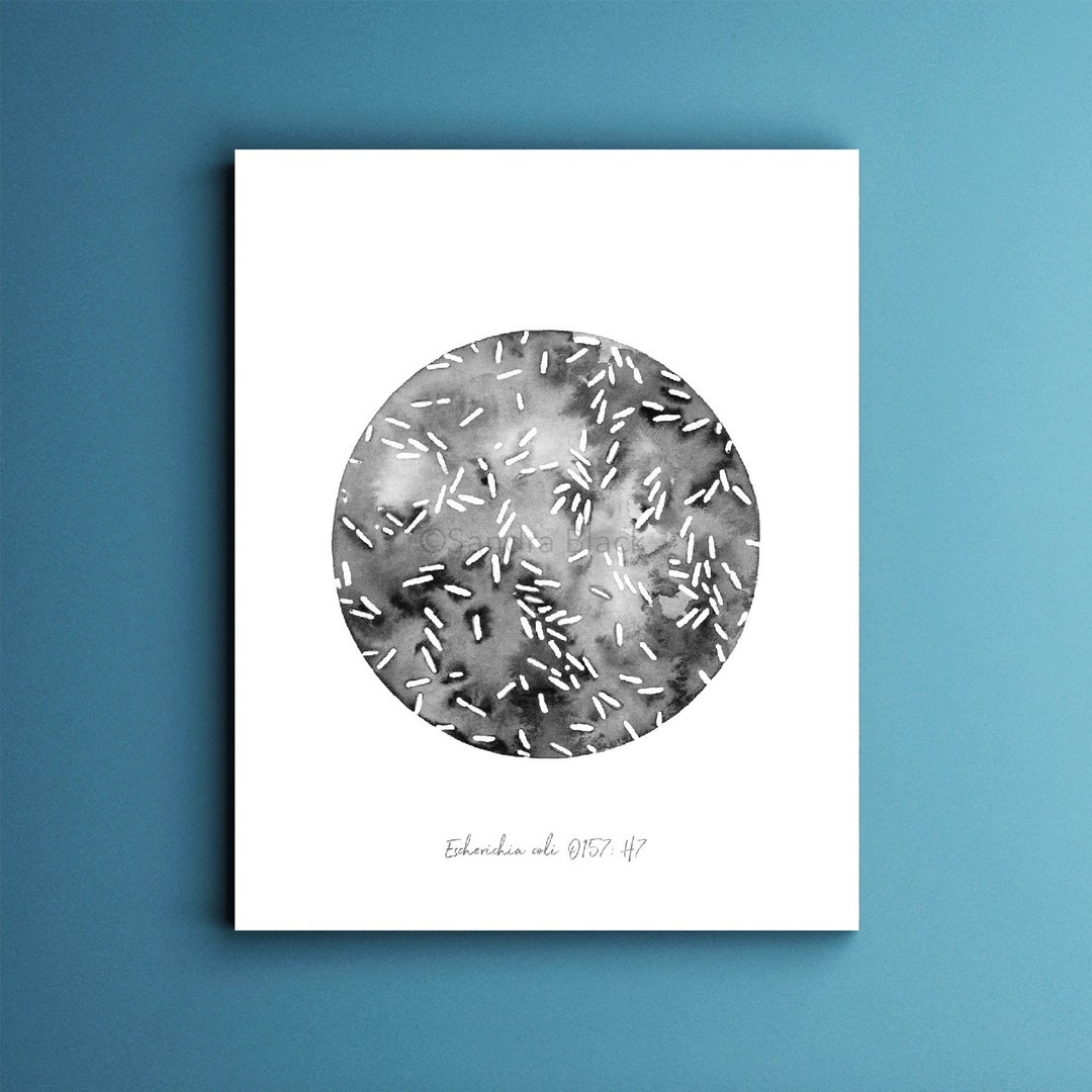 Escherichia Coli 0157:H7, Bacteria Art, Microbiology, Microbiology Art ...