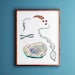 Amniotic Ferning, Microscopy, Obstetrics, OBGYN, Pregnancy, Medical Art ...