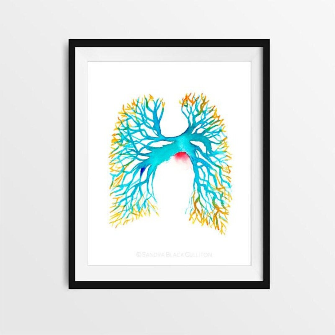Angiogram, Art Print, Science, Science Art, Science Print, Science Gift ...