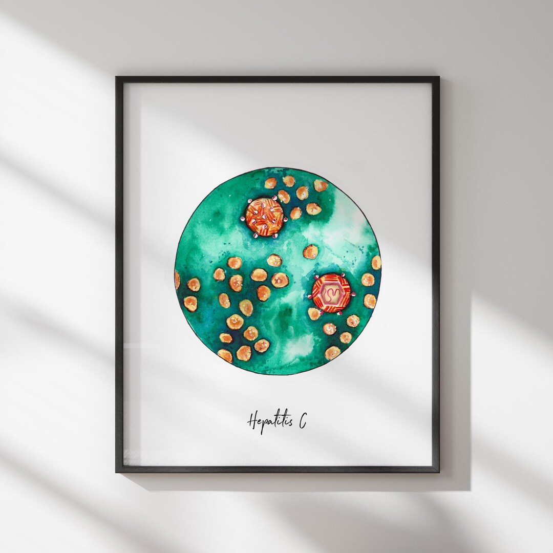 Hepatitis C, Medical Print, Virus, Virology, Microbiology, Virus Print ...