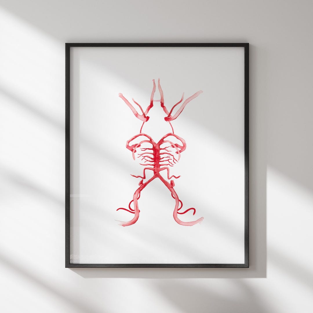 Circle of Willis: Medical Anatomy Art Science Poster Print - Etsy