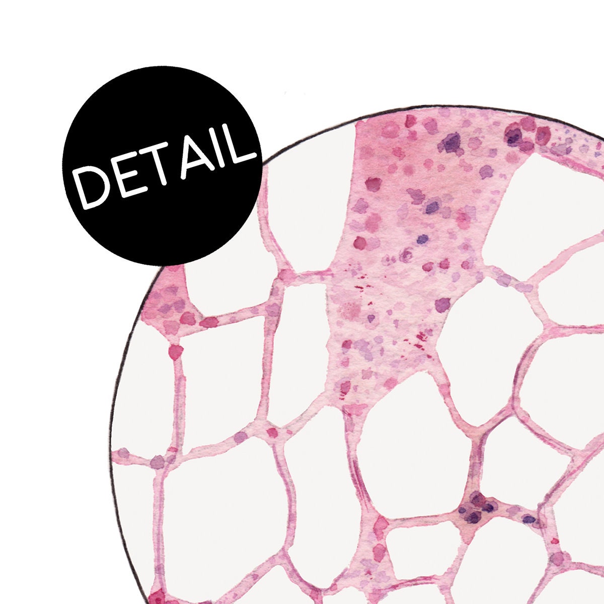 Aplastic Anemia Bone Marrow Histology Histology Art Etsy