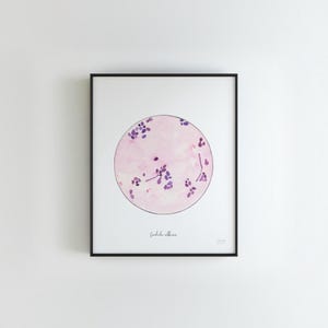 Candida Albicans: Art Print Microbiology Mycology Science - Etsy