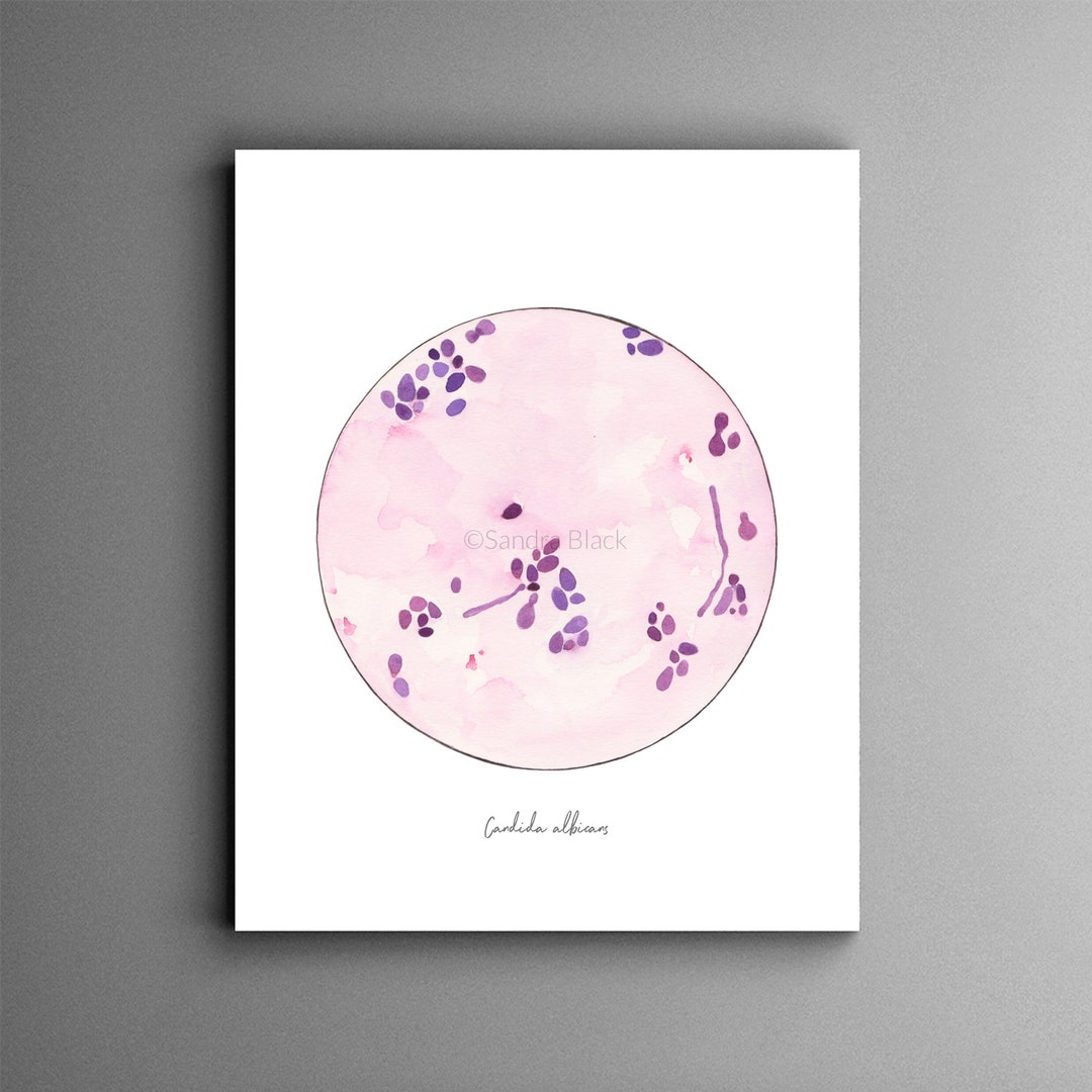Candida Albicans, Microbiology, Mycology, Microbiology Art, Science ...