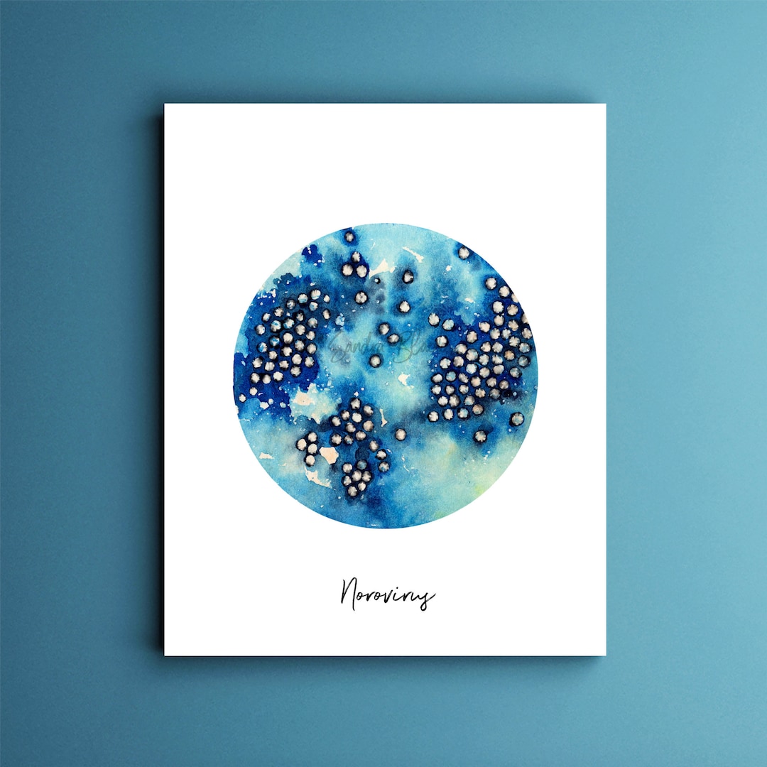 Norovirus, Virus, Virology, Microbiology, Science Art, Medical Art ...