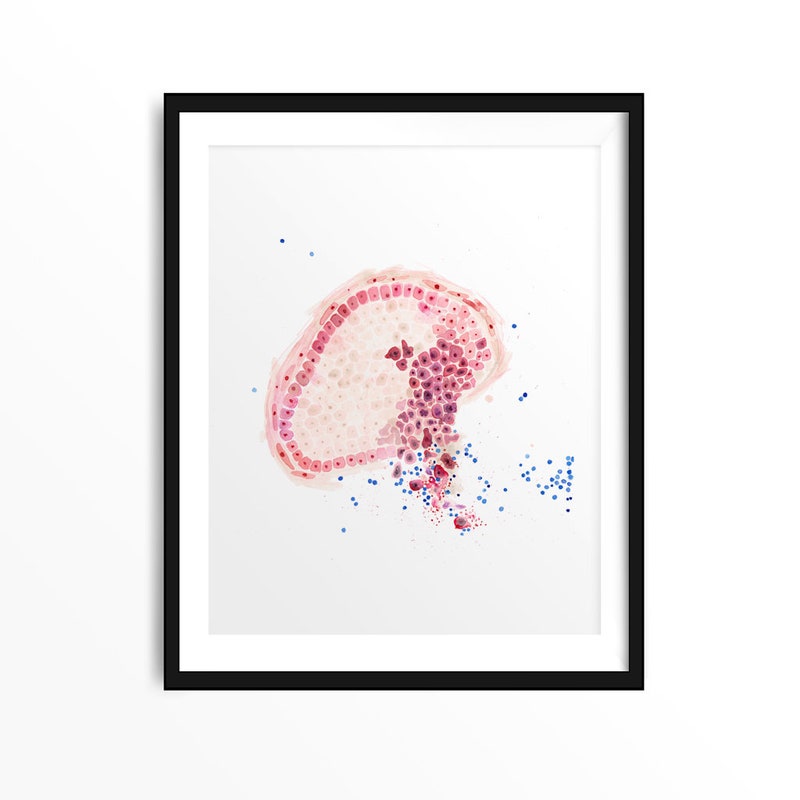 Breast Cancer Art - Etsy