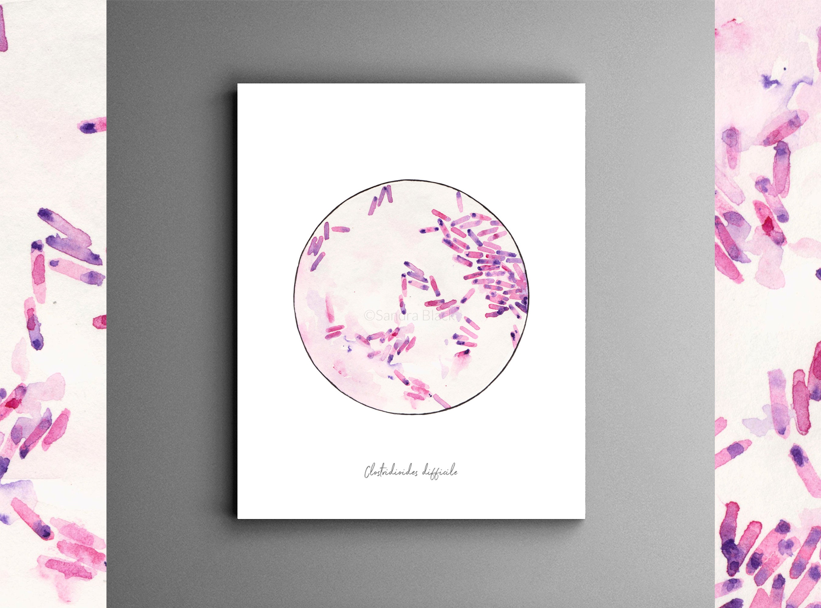 Clostridium Difficile Gram Stain
