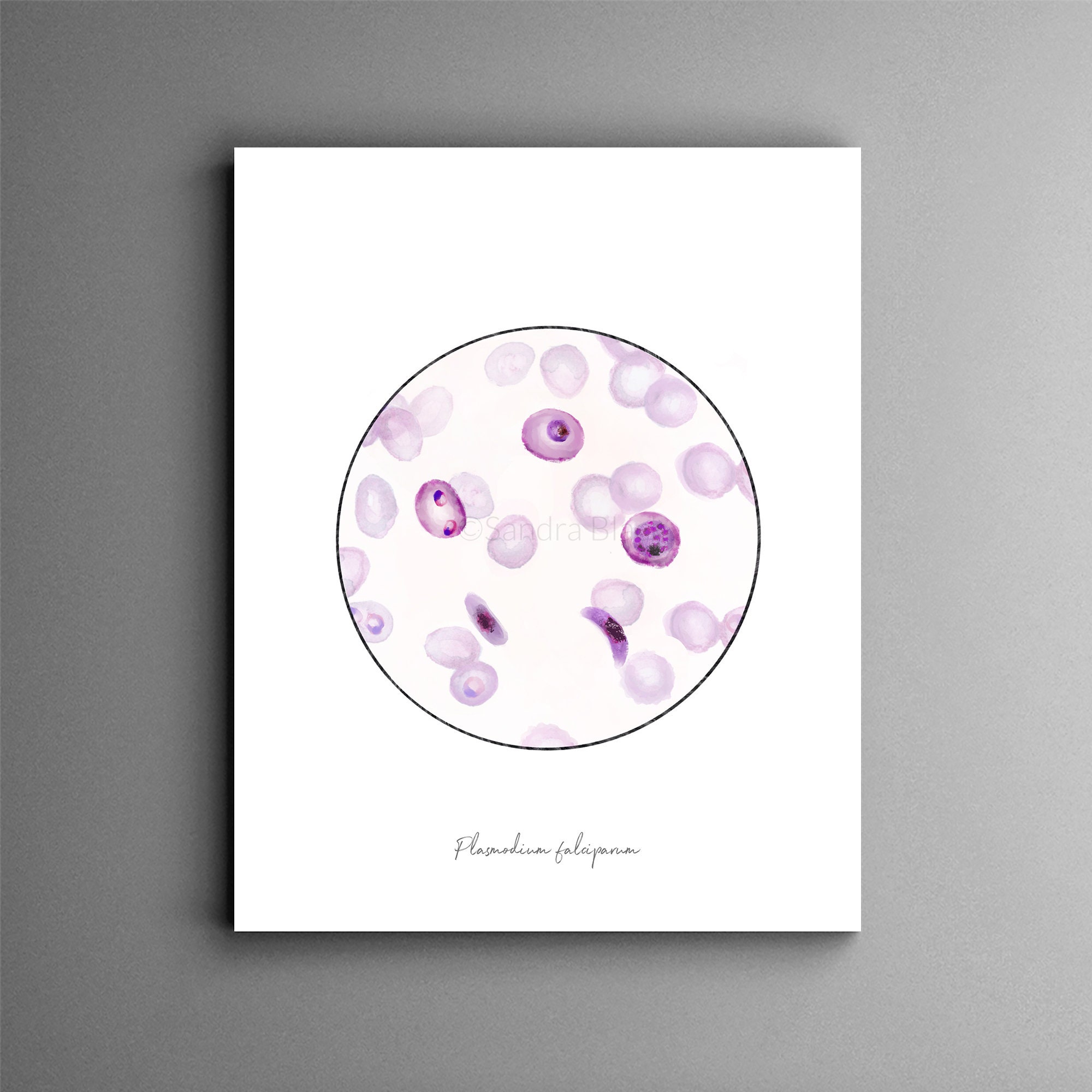 Plasmodium Falciparum Labeled