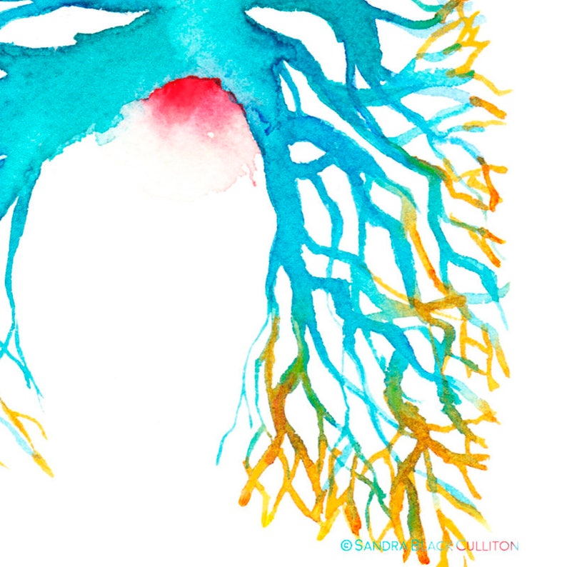 Angiogram Art Print Science Science Art Science Print - Etsy