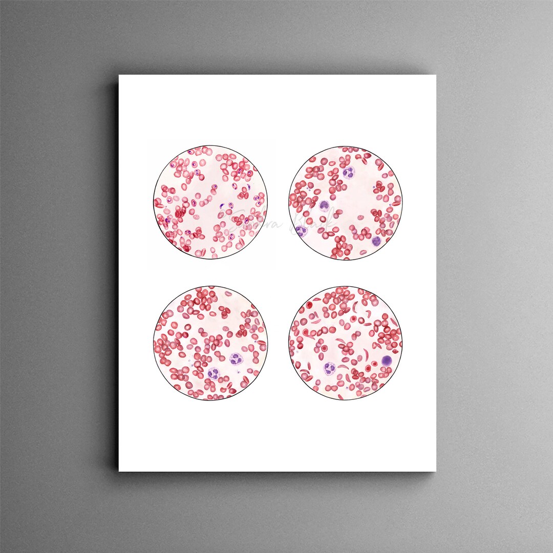 Blood Smear Collection, Science Art, Biology Art, Science Gift, Red Blood Cells, Watercolor ...