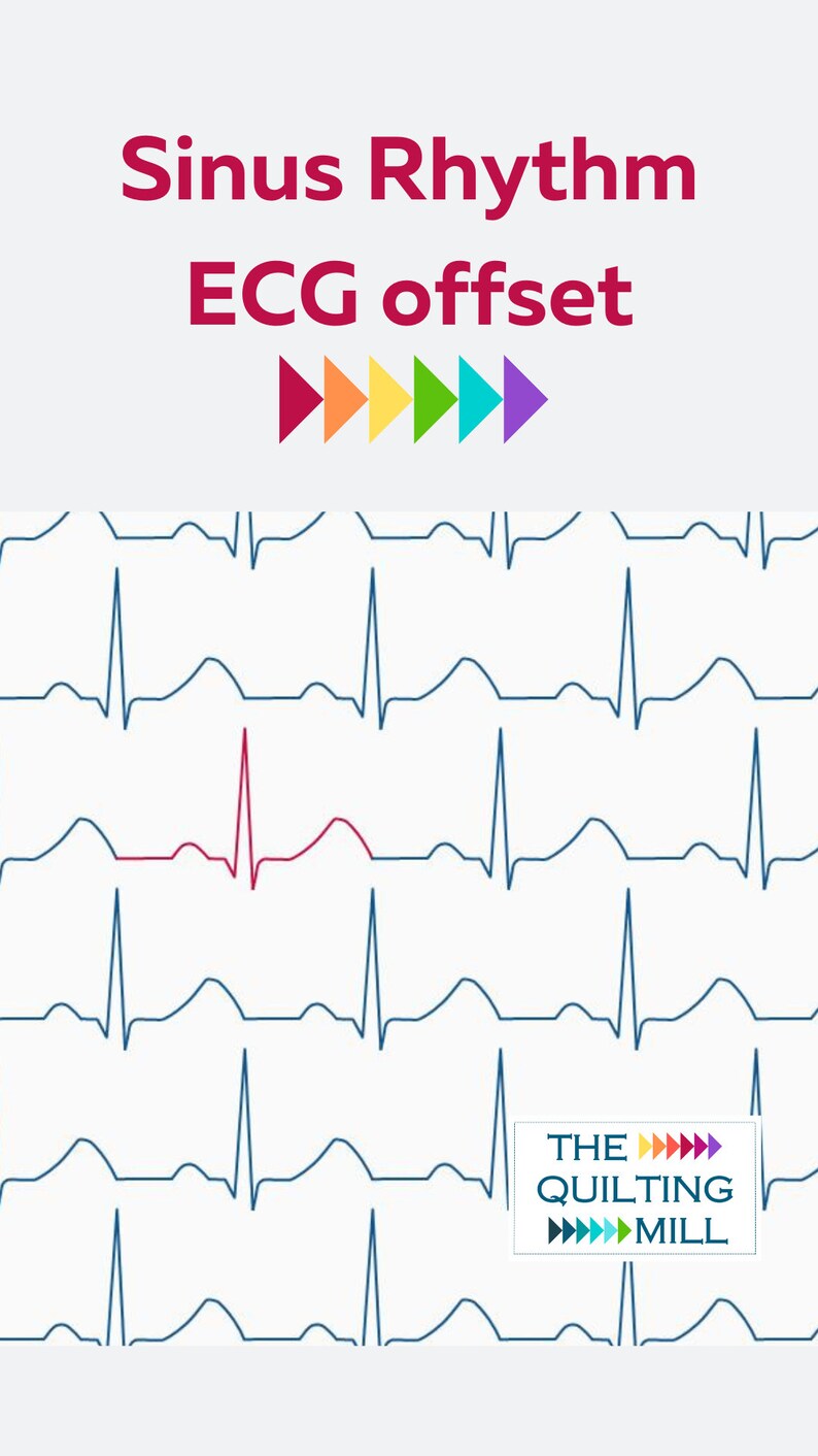Normal Sinus ECG - Heartbeat Quilting Pantograph | Digital Longarm ...