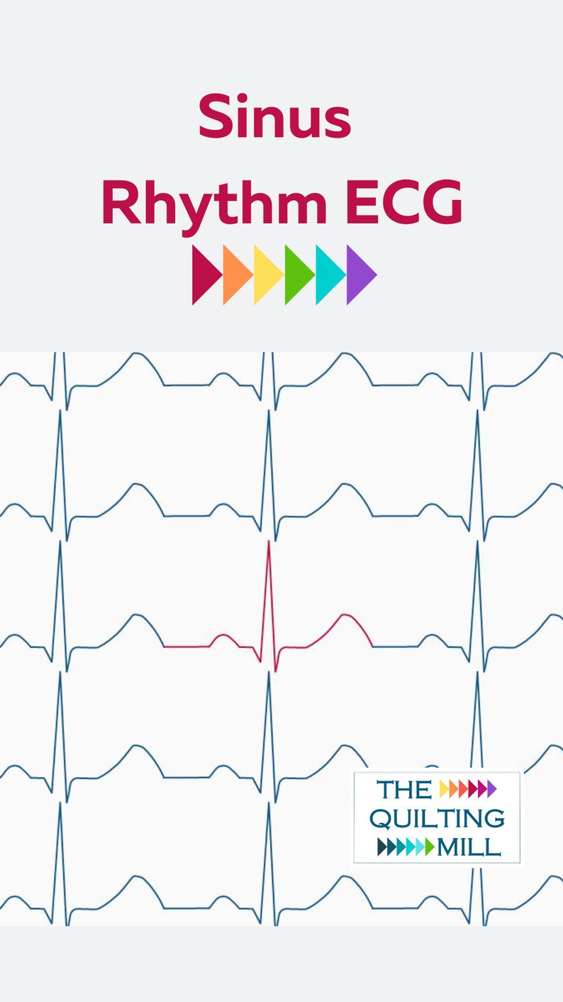 Normal Sinus ECG - Heartbeat Quilting Pantograph | Digital Longarm ...