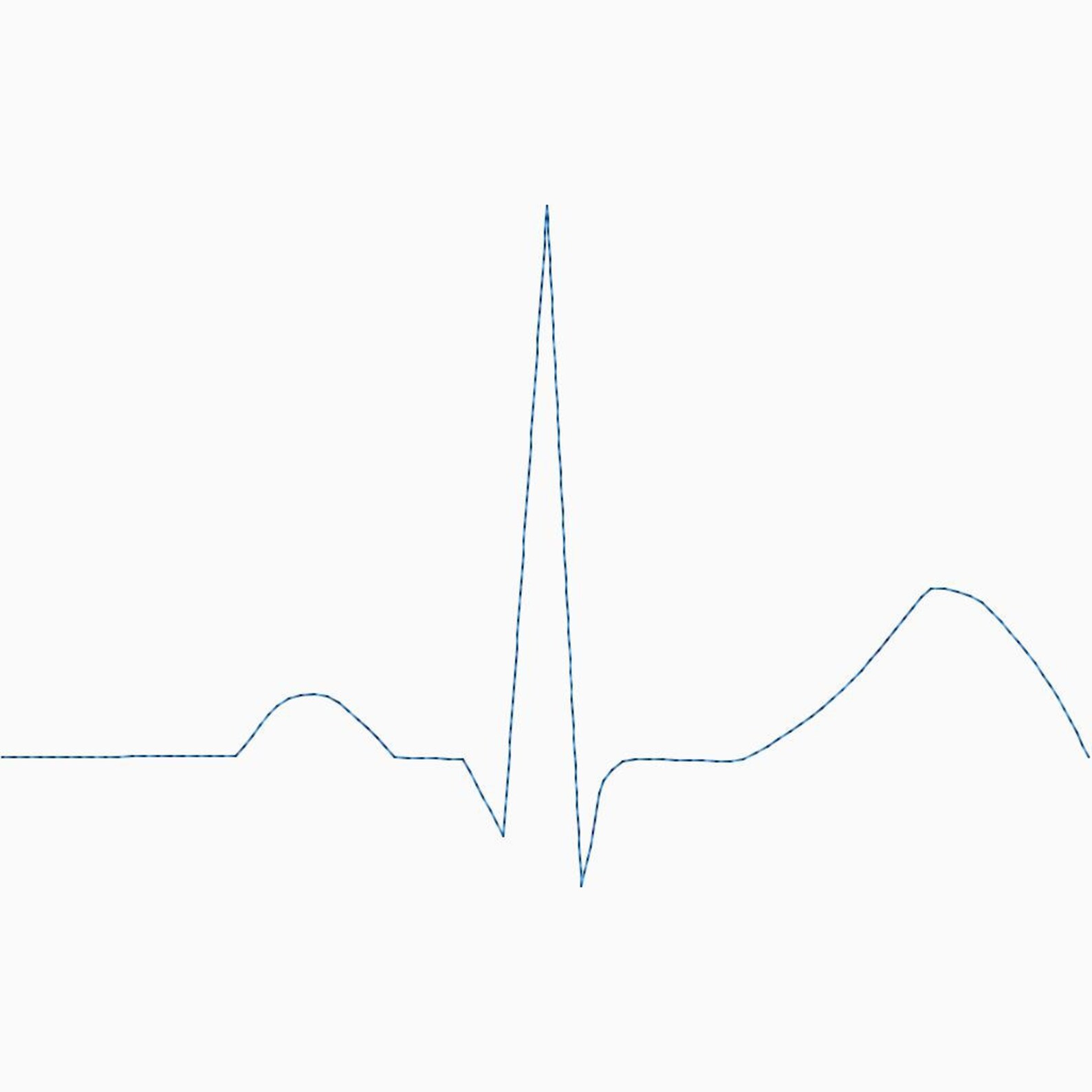 Normal Sinus ECG - Heartbeat Quilting Pantograph | Digital Longarm ...