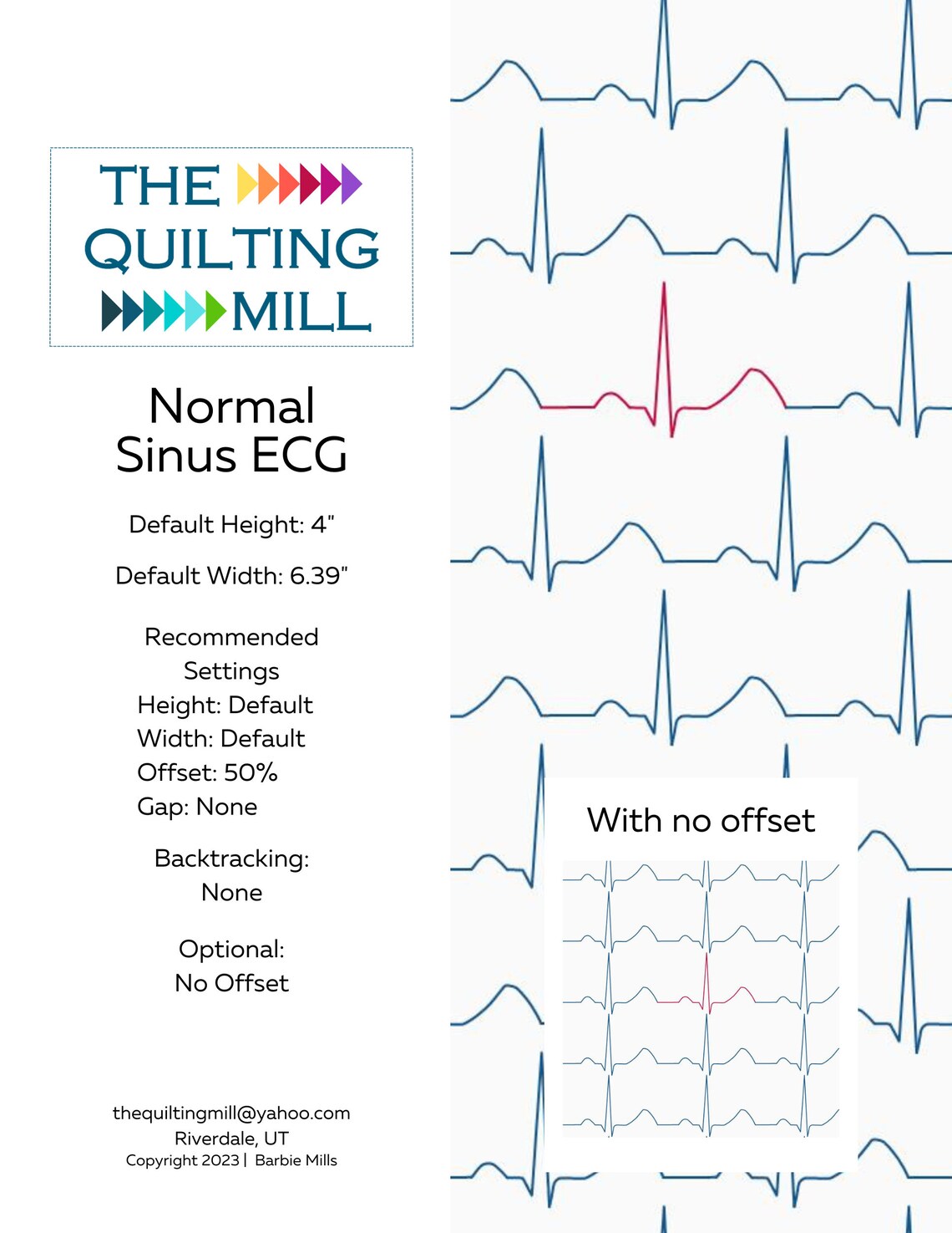 Normal Sinus ECG - Heartbeat Quilting Pantograph | Digital Longarm ...