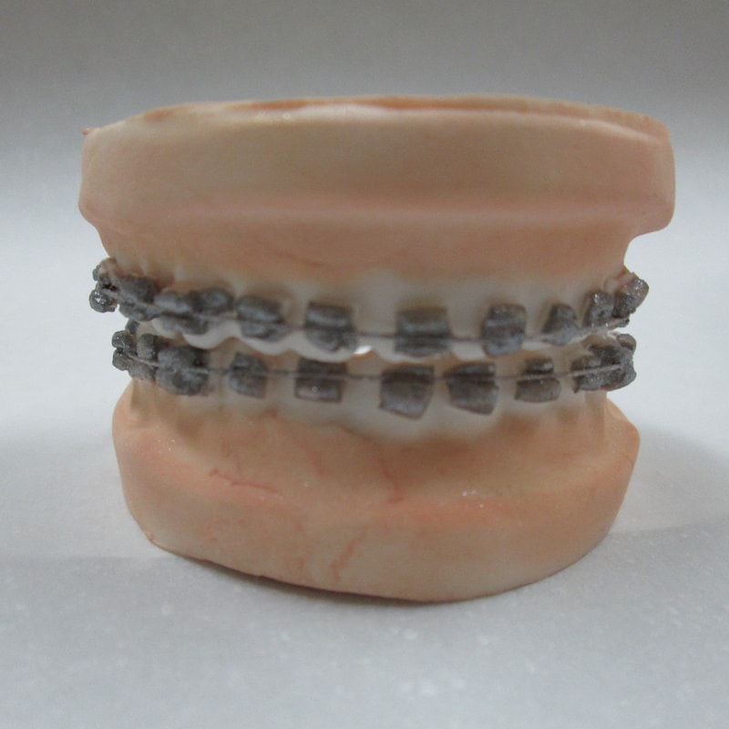 Fake Braces Etsy