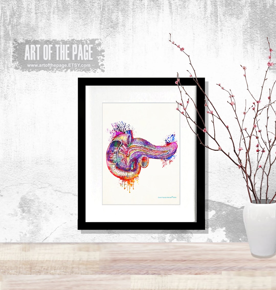 Anatomy Medical Print, watercolor Pancreas, 8.5 X 11 Print, Nurse Gift ...