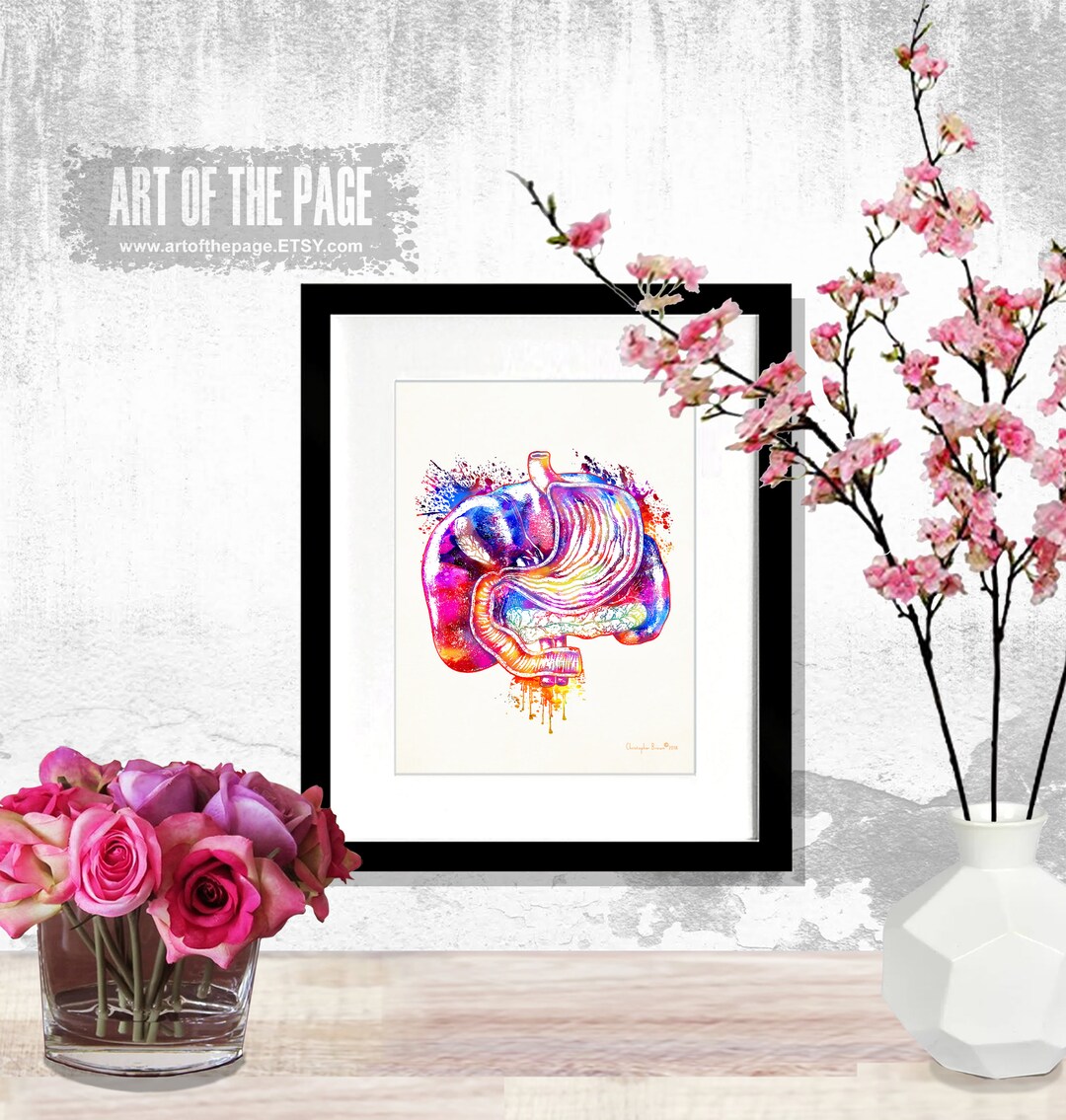 Anatomy Medical Print, "watercolor Stomach", 8.5" X 11" Print, Doctor ...