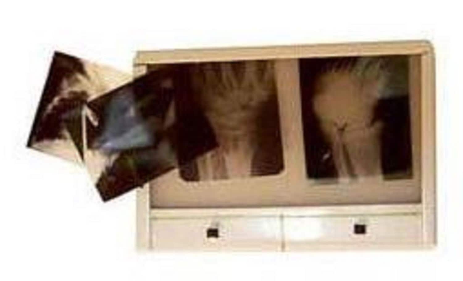 Dollhouse Miniature Handcrafted Medical Hospital X-ray Viewer Screen 1 ...