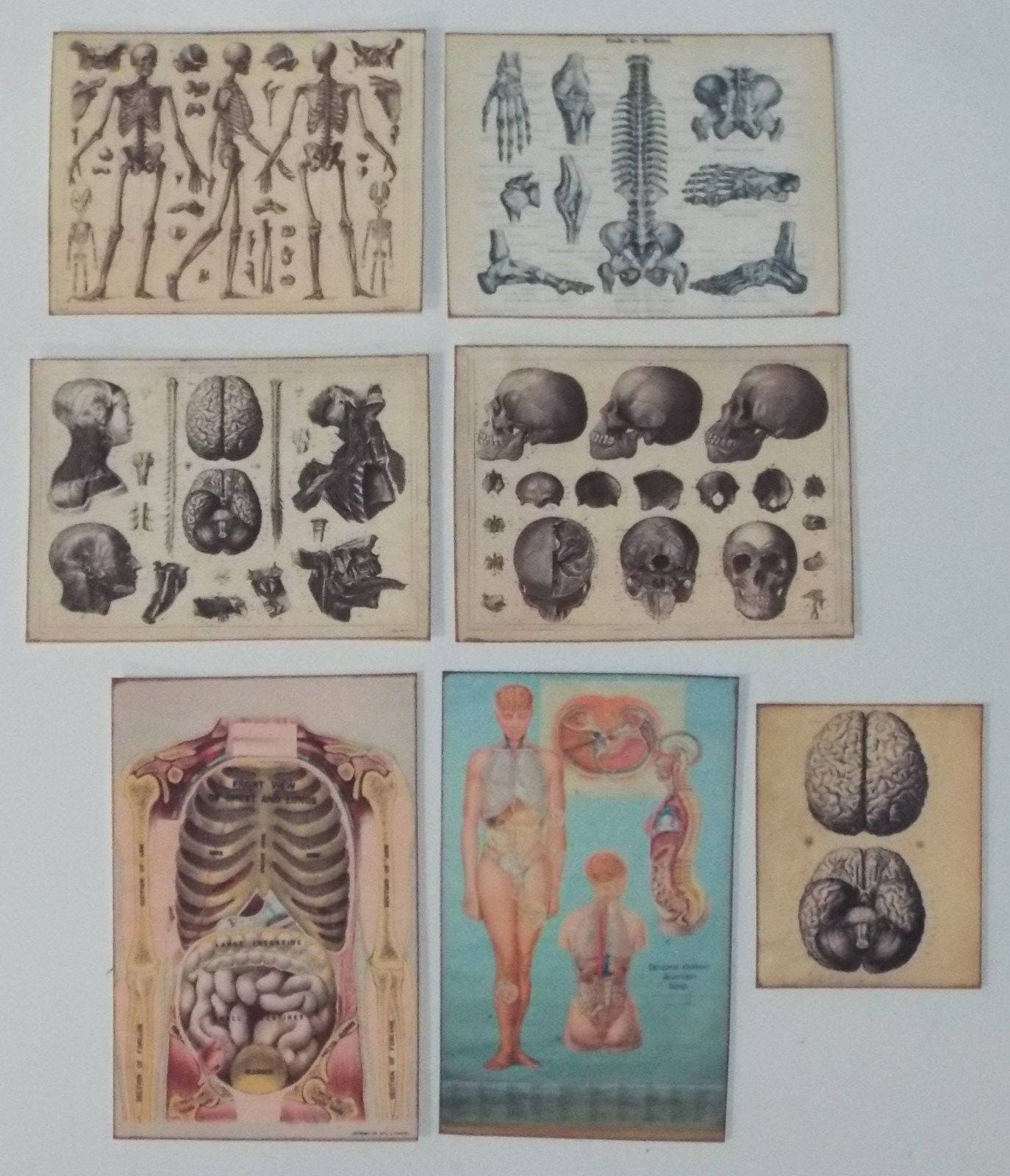 Old Medical Posters