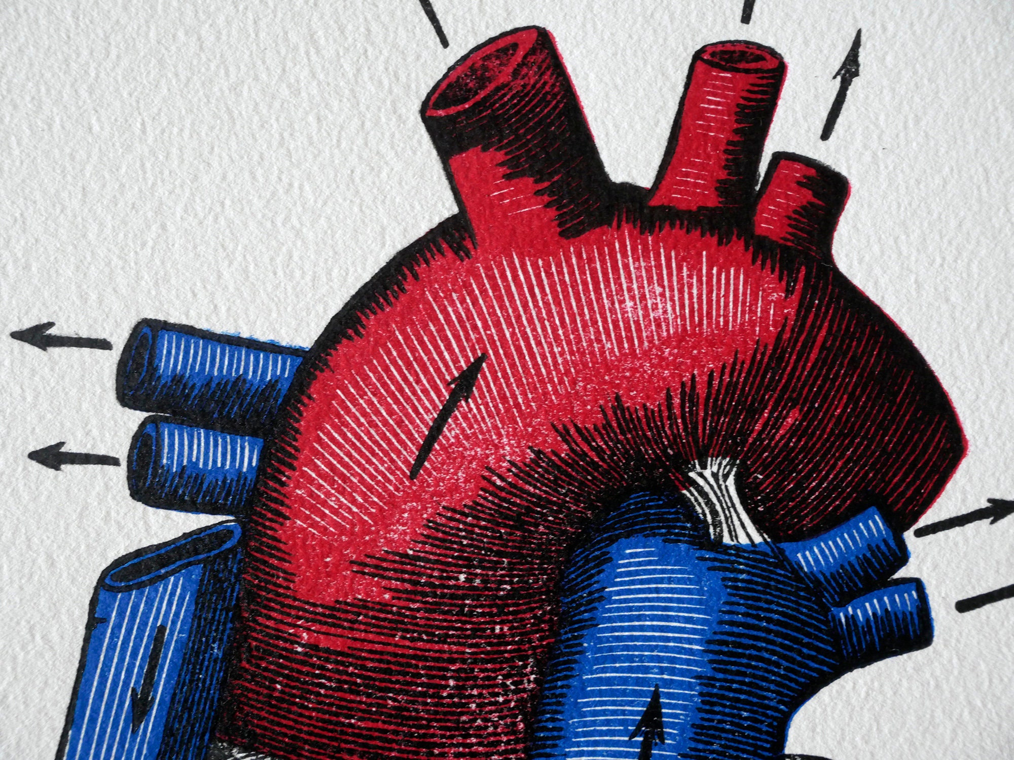 Beat Box IV - Heart - Anatomy - Linocut - Etsy