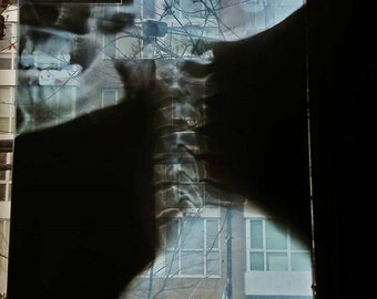 X Ray Pictures | Etsy