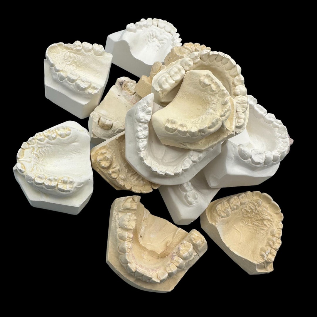 Vintage Plaster Dental Mold - Teeth Tooth Mold - Creepy Oddity - Dental ...