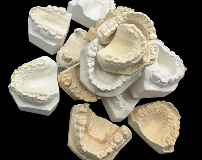 Vintage Plaster Dental Mold Teeth Tooth Mold Creepy Oddity Dental ...