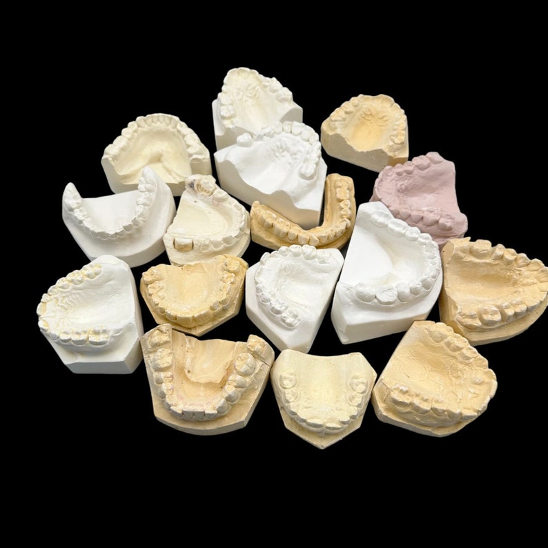 Vintage Plaster Dental Mold - Teeth Tooth Mold - Creepy Oddity - Dental ...