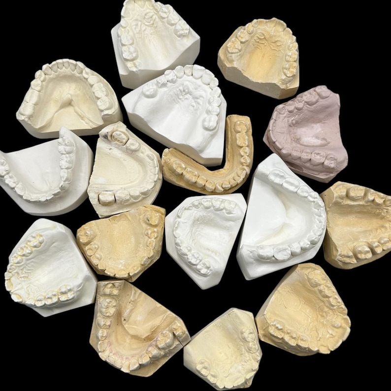 Vintage Plaster Dental Mold - Teeth Tooth Mold - Creepy Oddity - Dental ...