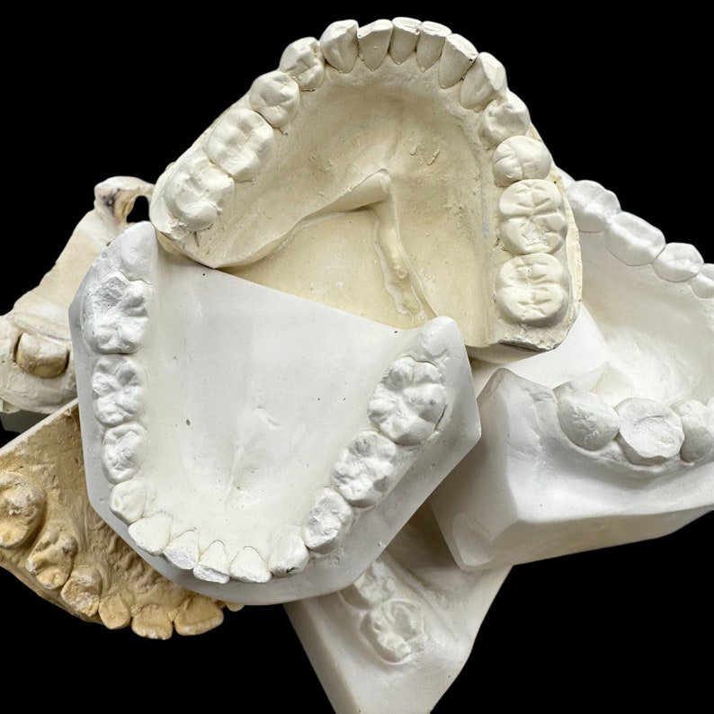 Vintage Plaster Dental Mold - Teeth Tooth Mold - Creepy Oddity - Dental ...