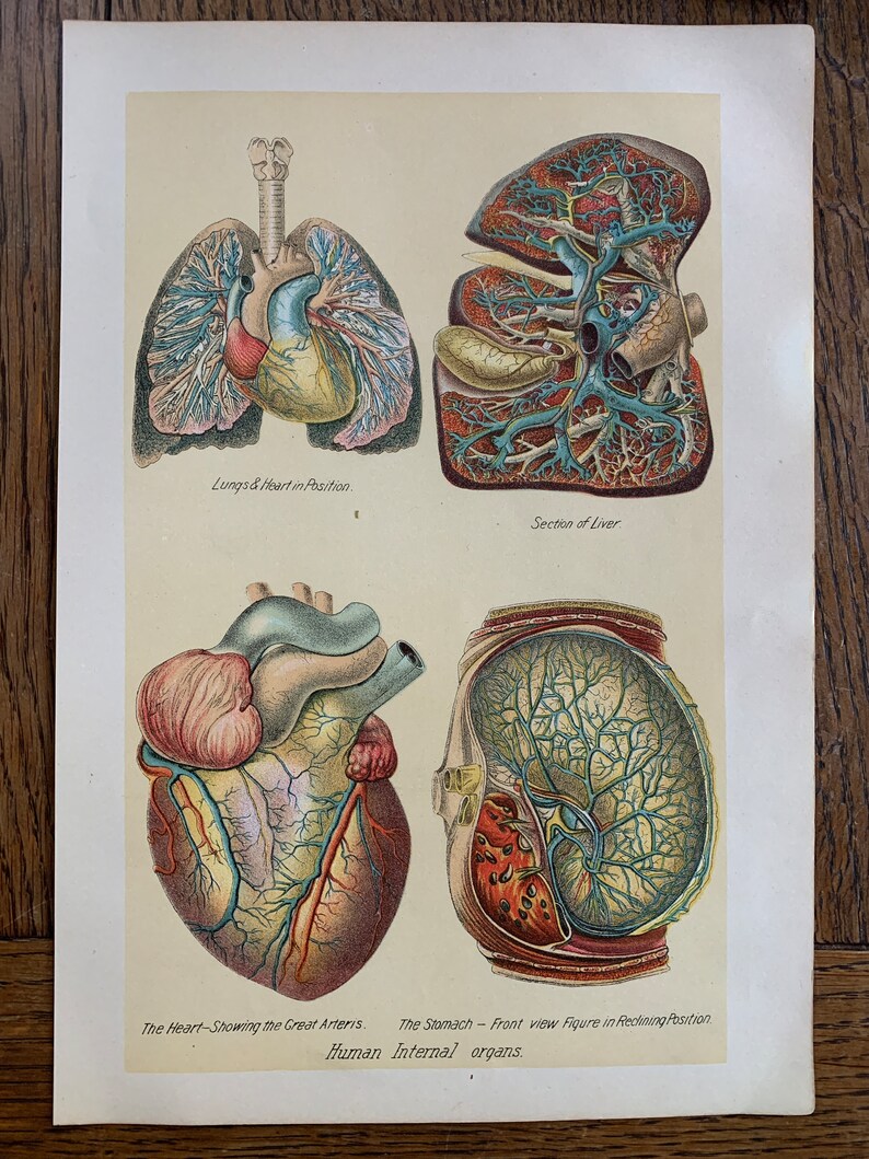 1903 Antique Anatomy Lithograph Plate Print From Rare Medical - Etsy