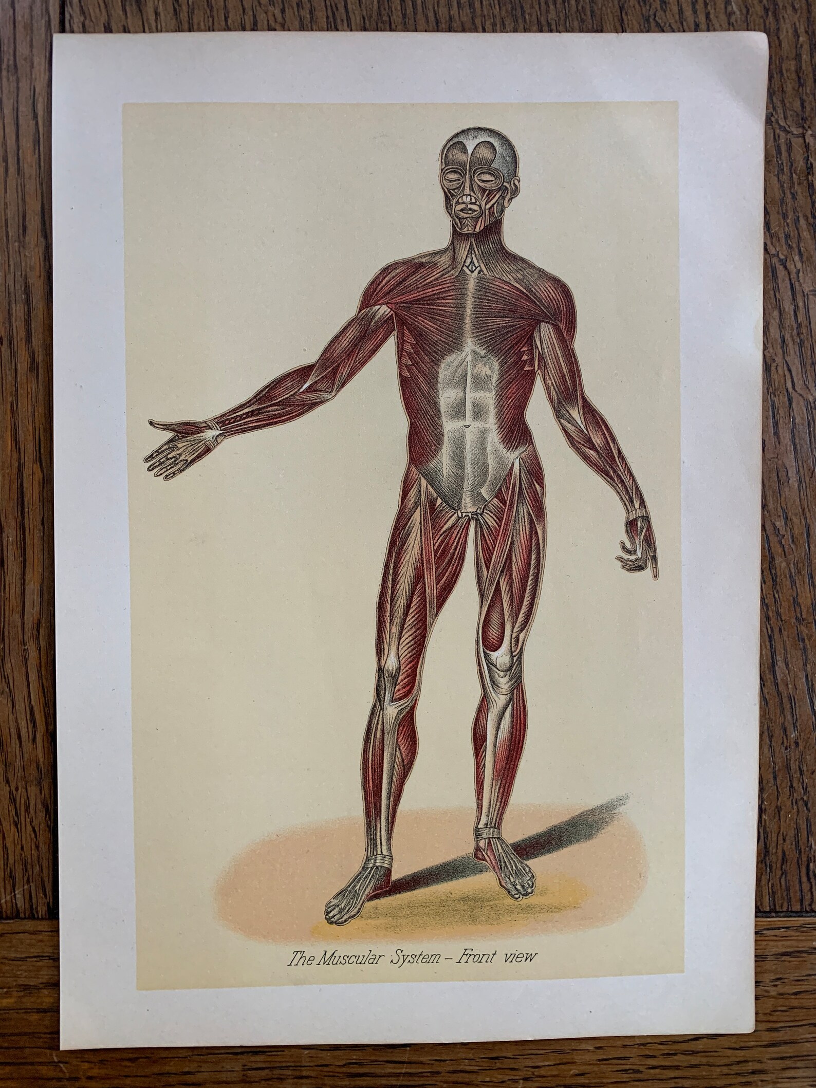 1903 Antique Anatomy Lithograph Plate Print From Rare Medical - Etsy