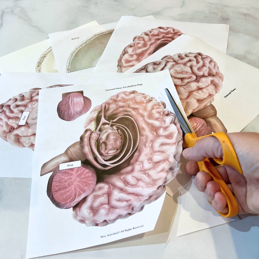 Anatomy HUMAN BRAIN - Full Color Anatomically Correct 2D Dissection ...