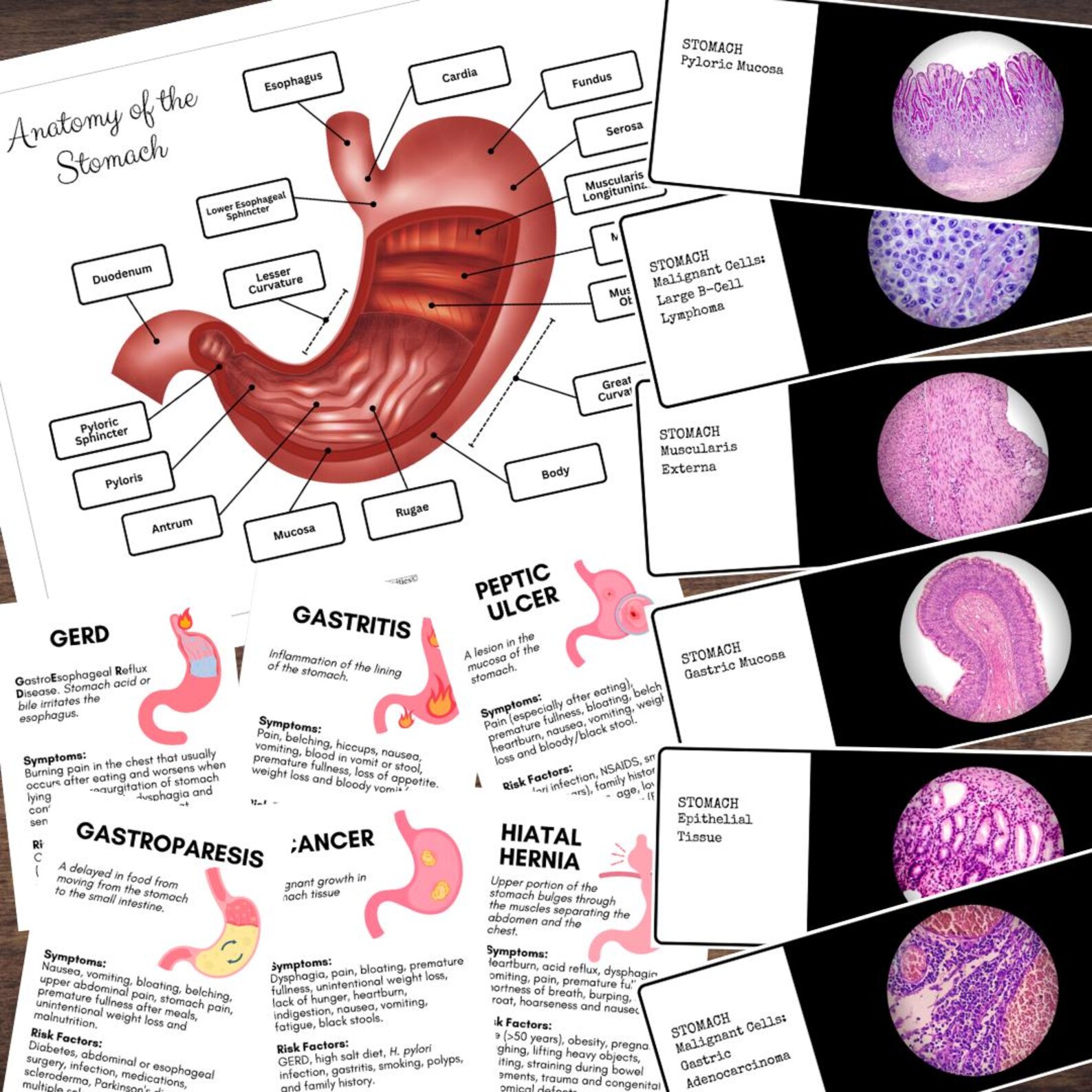 HUMAN Anatomy STOMACH Model - Anatomically Correct 2D Dissection ...