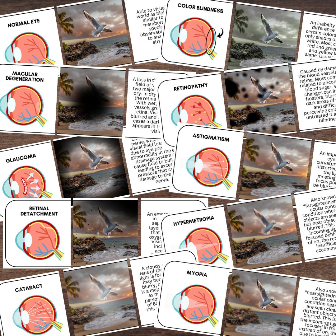 HUMAN Anatomy EYE Model - Anatomically Correct 2D Dissection Labeling ...