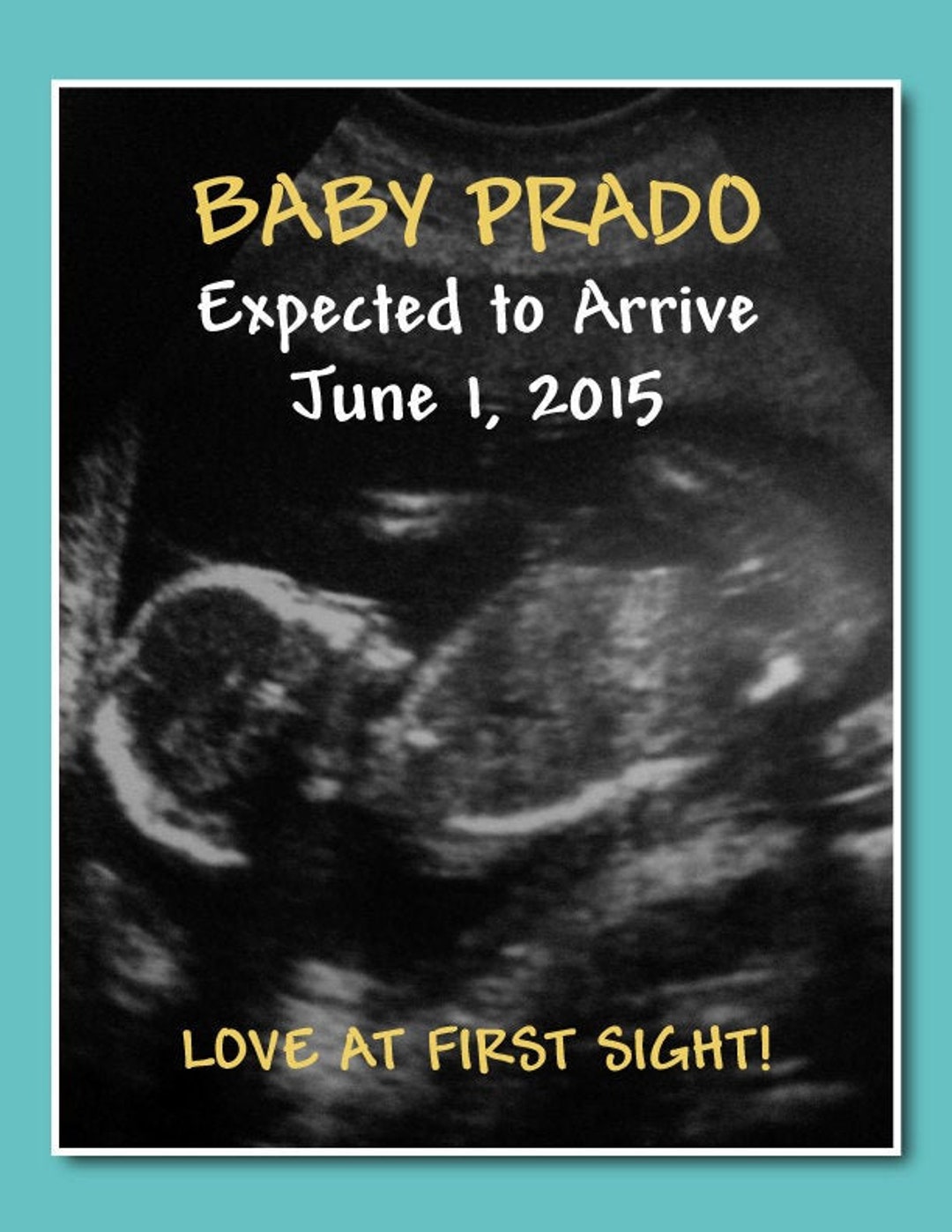 Custom PRINTABLE Sonogram Sign for Baby Shower - 8.5x11 - Etsy