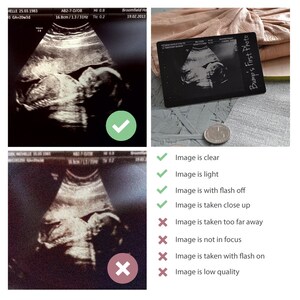 Baby Scan Wallet Keepsake Card Metal Wallet Card Baby Scan Photo ...