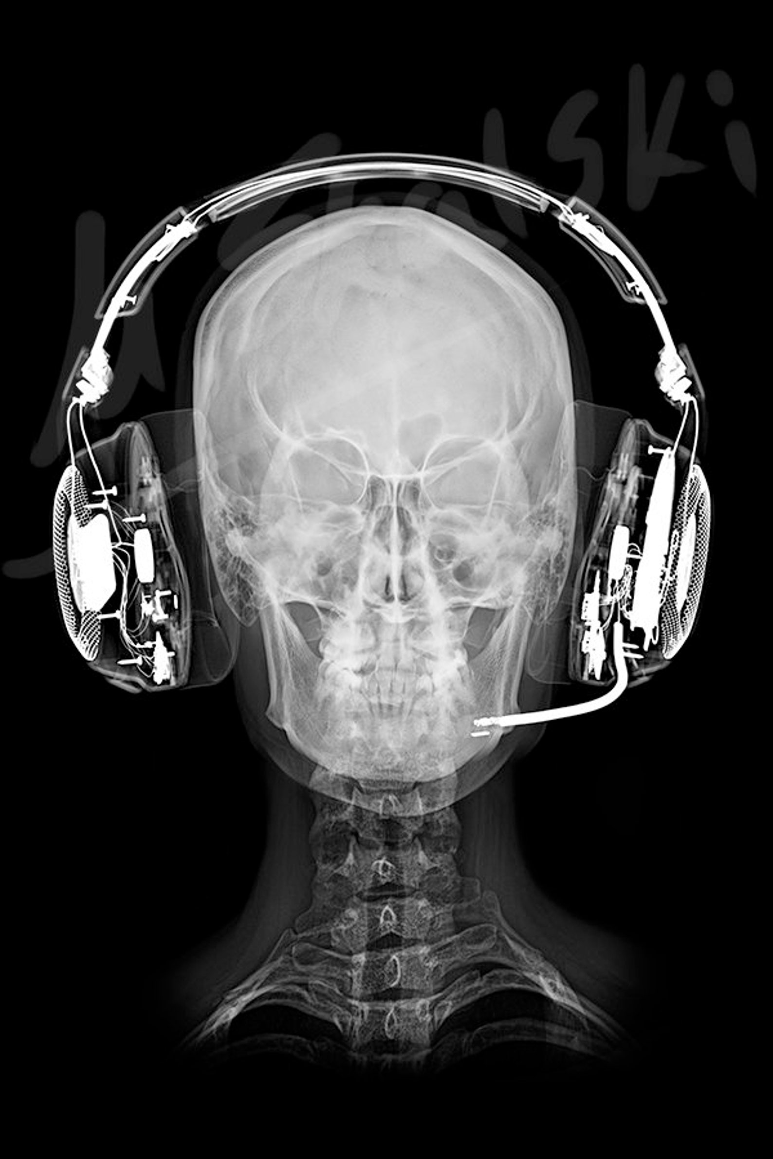 X-ray Fine Art Prints - Etsy