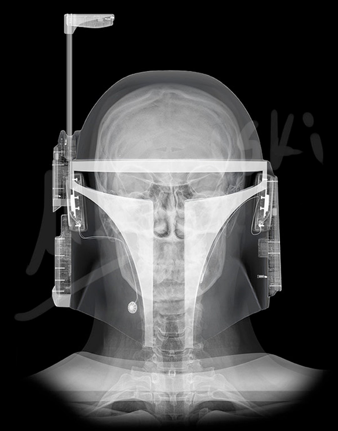 X-ray Fine Art Prints - Etsy