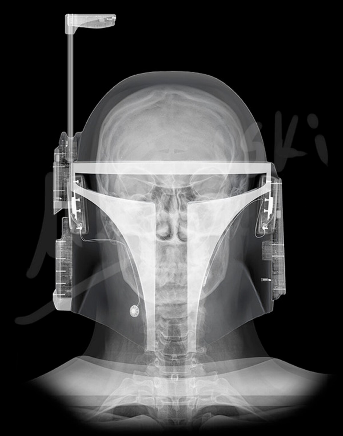 X-ray Fine Art Prints - Etsy