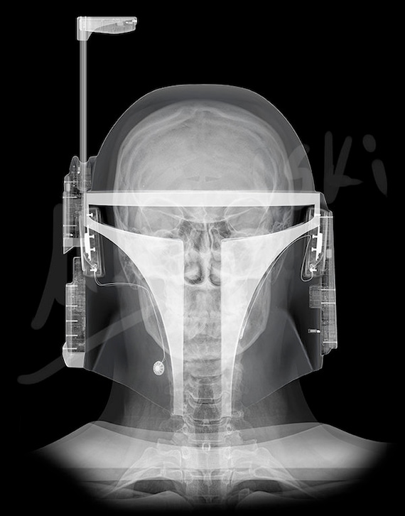 X-ray Fine Art Prints | Etsy