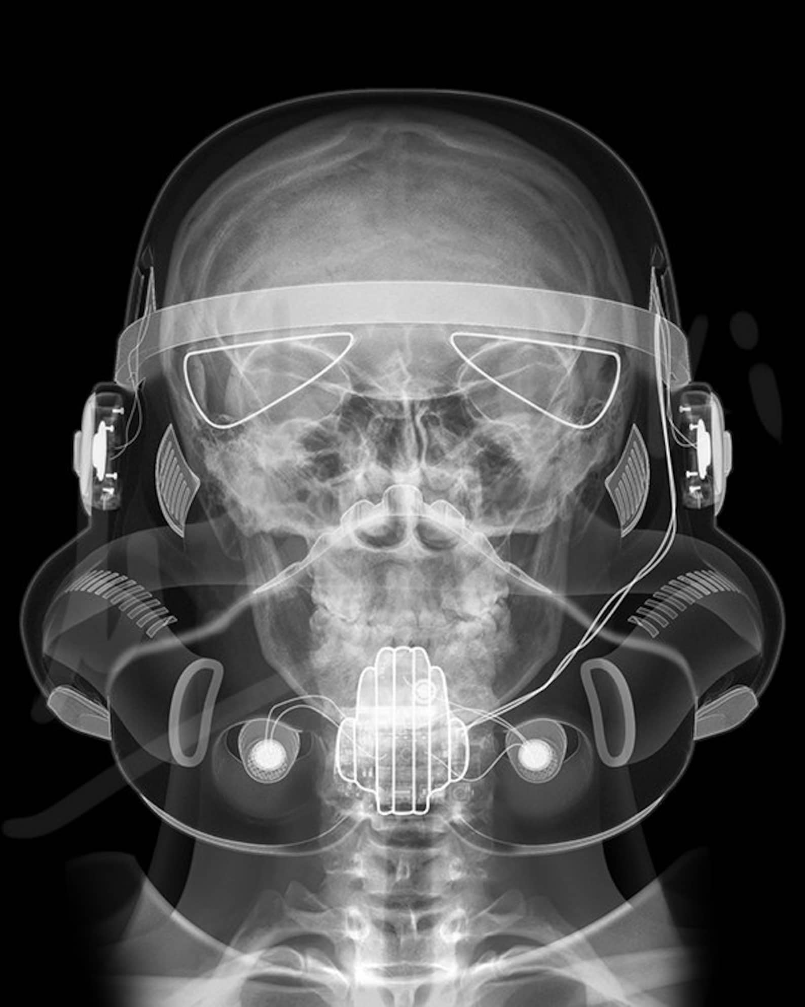 X-ray Fine Art Prints - Etsy