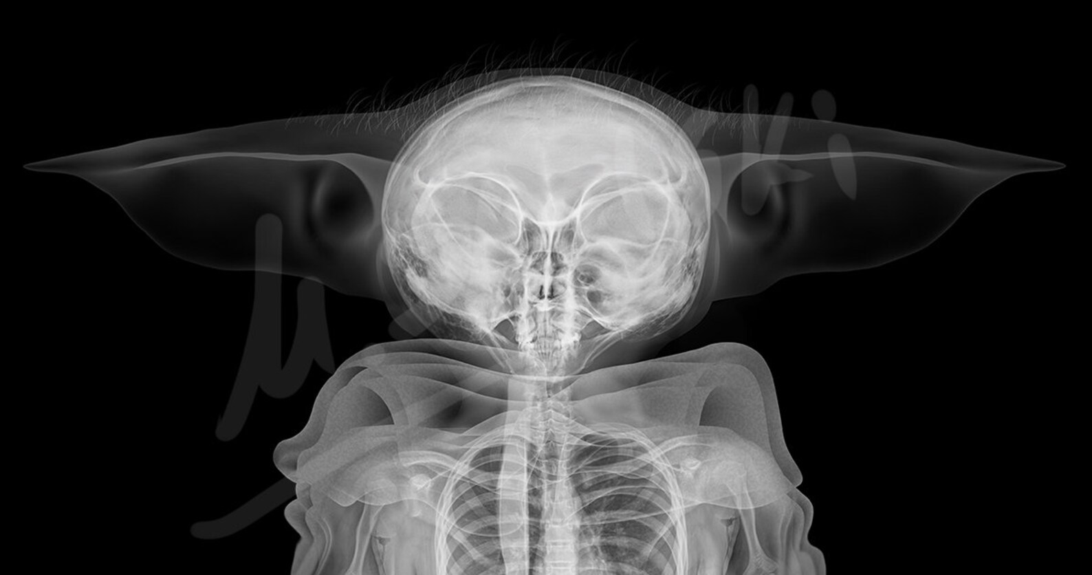 X-ray Fine Art Prints | Etsy