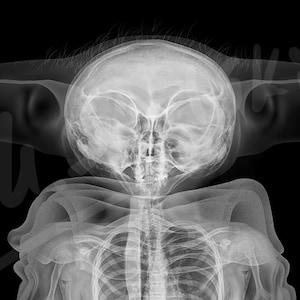 X-ray Fine Art Prints - Etsy