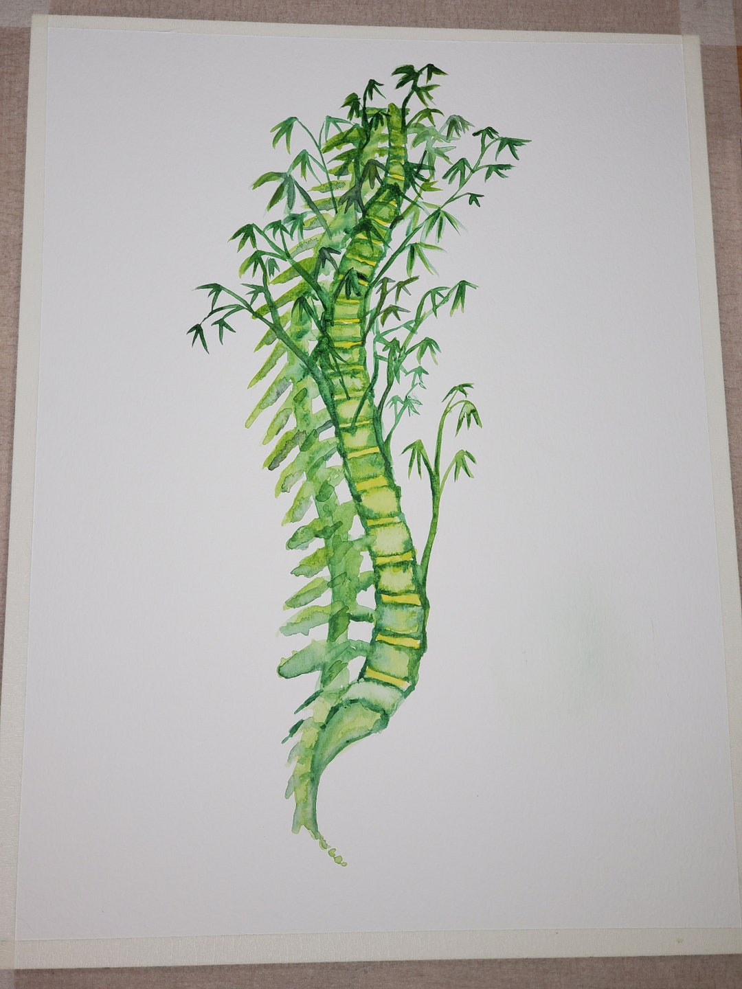 Bamboo Spine Watercolor Painting - Fine Art Print, Ankylosing ...