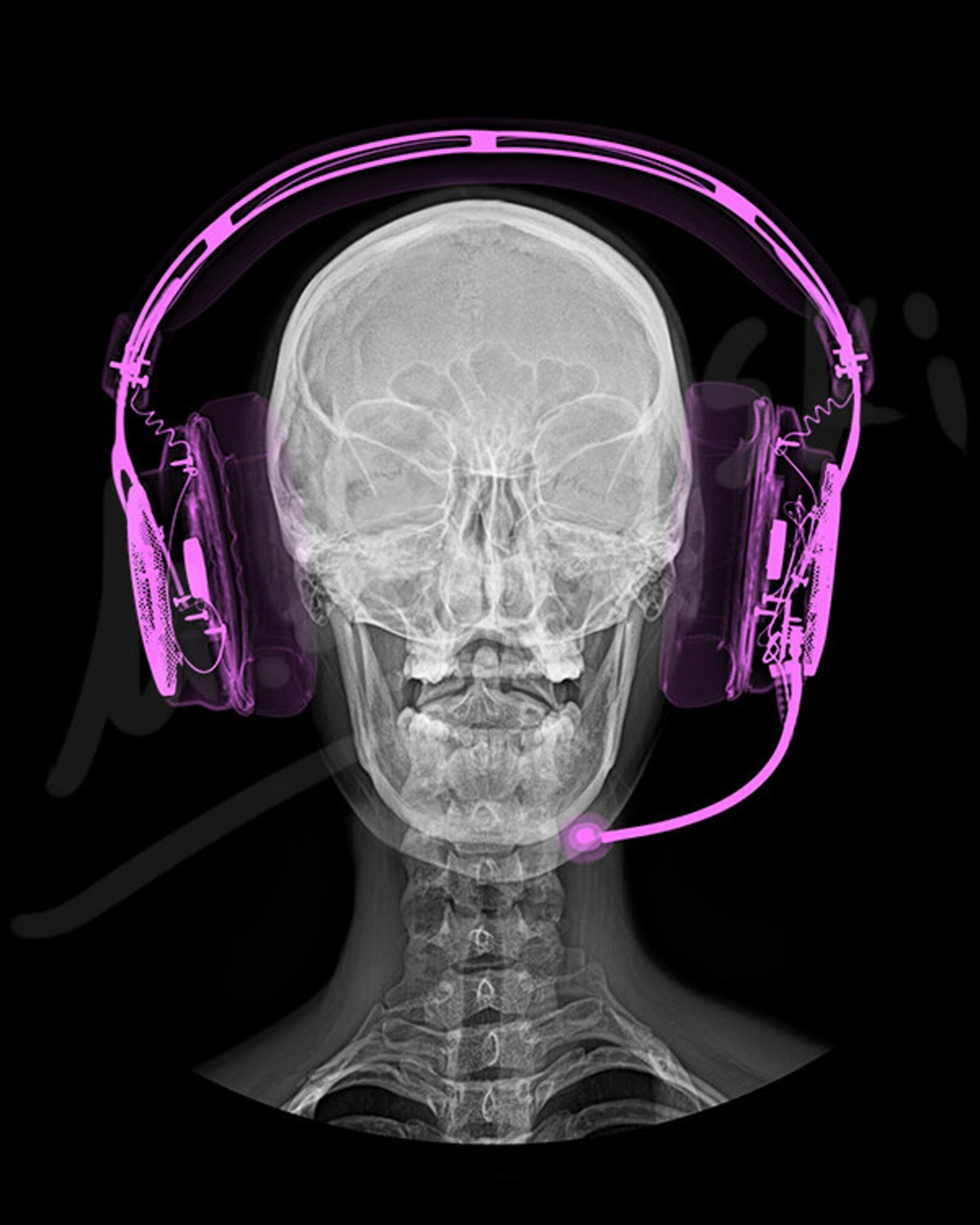 X-ray Fine Art Prints - Etsy