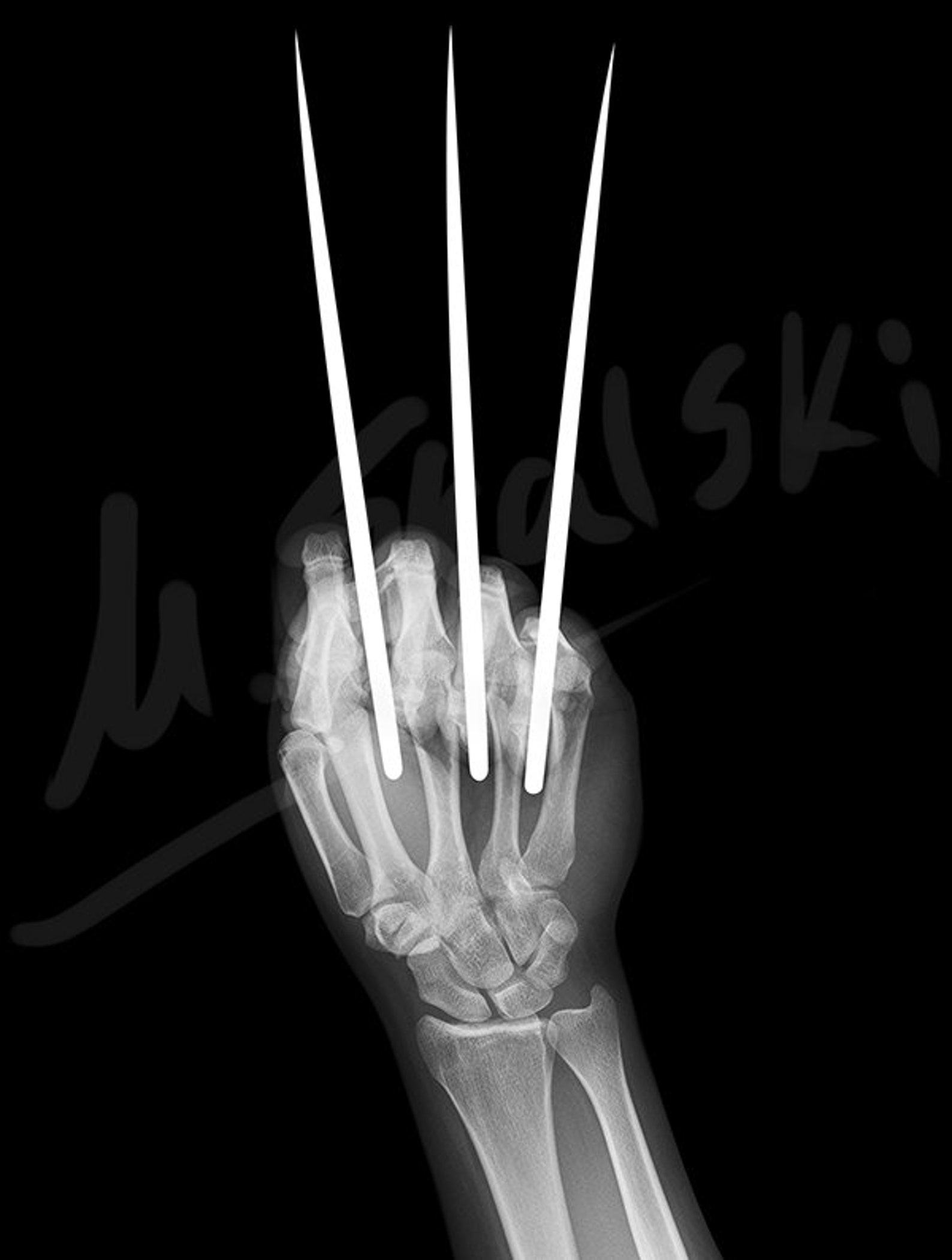 X-ray Fine Art Prints | Etsy