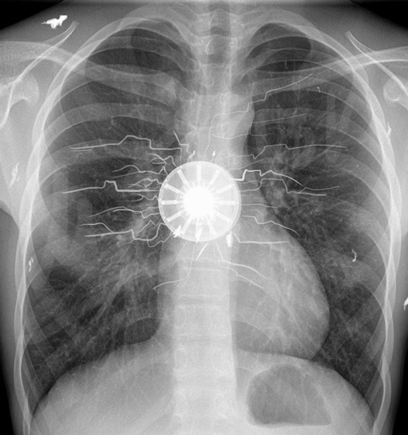 X-ray Fine Art Prints - Etsy